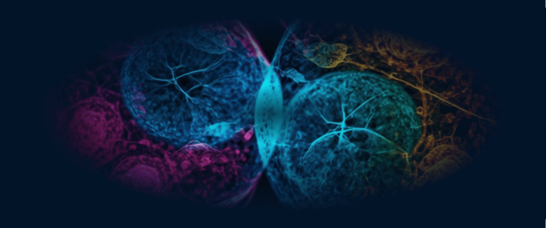 Exogenous Monounsaturated Fatty Acids Promote a Ferroptosis-Resistant ...